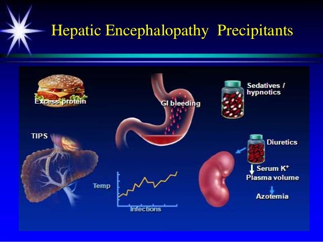 Management of hepatic encephalopathy