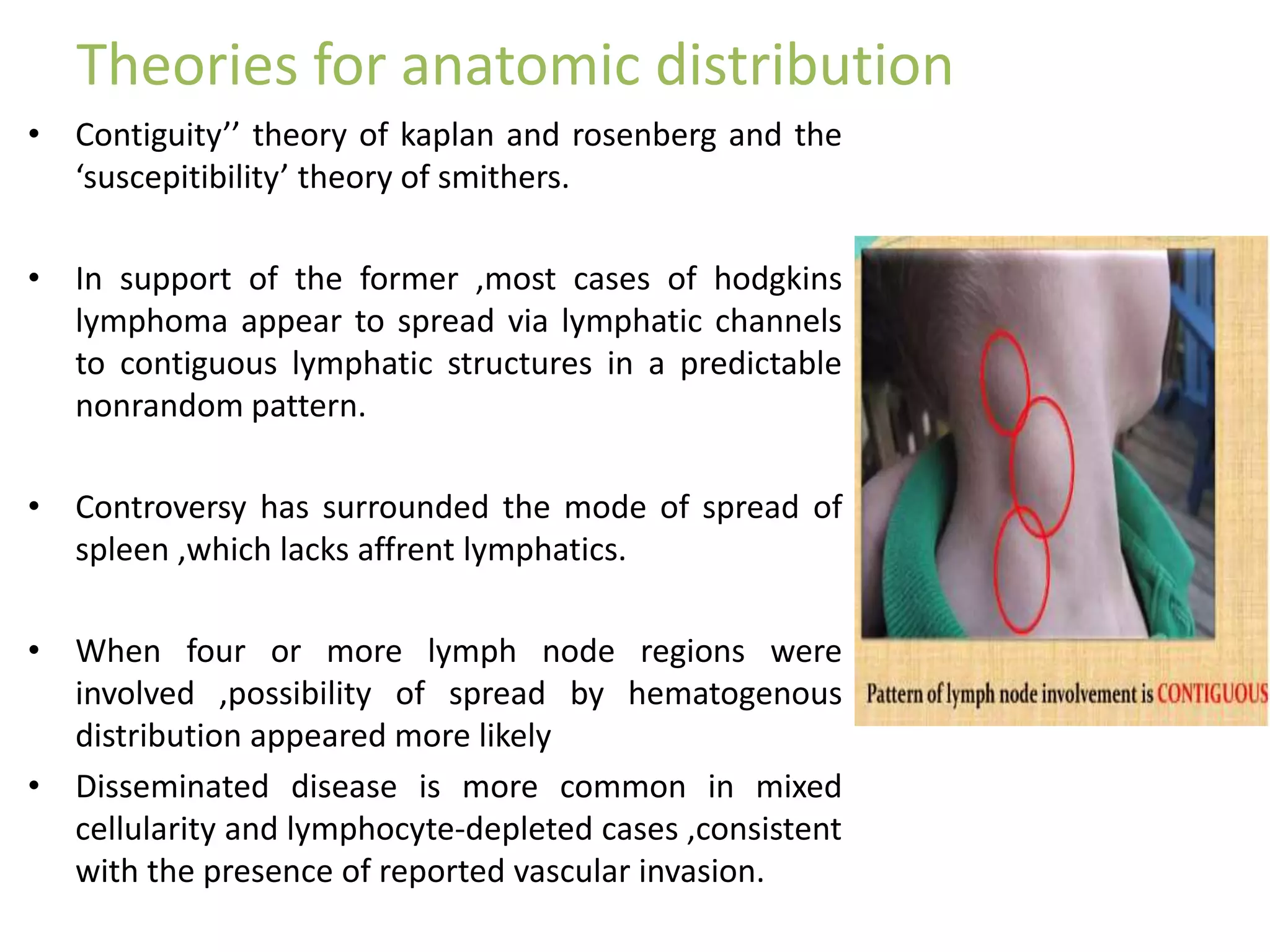 Management of hodgkin lymphoma.pptx123 | PPTX