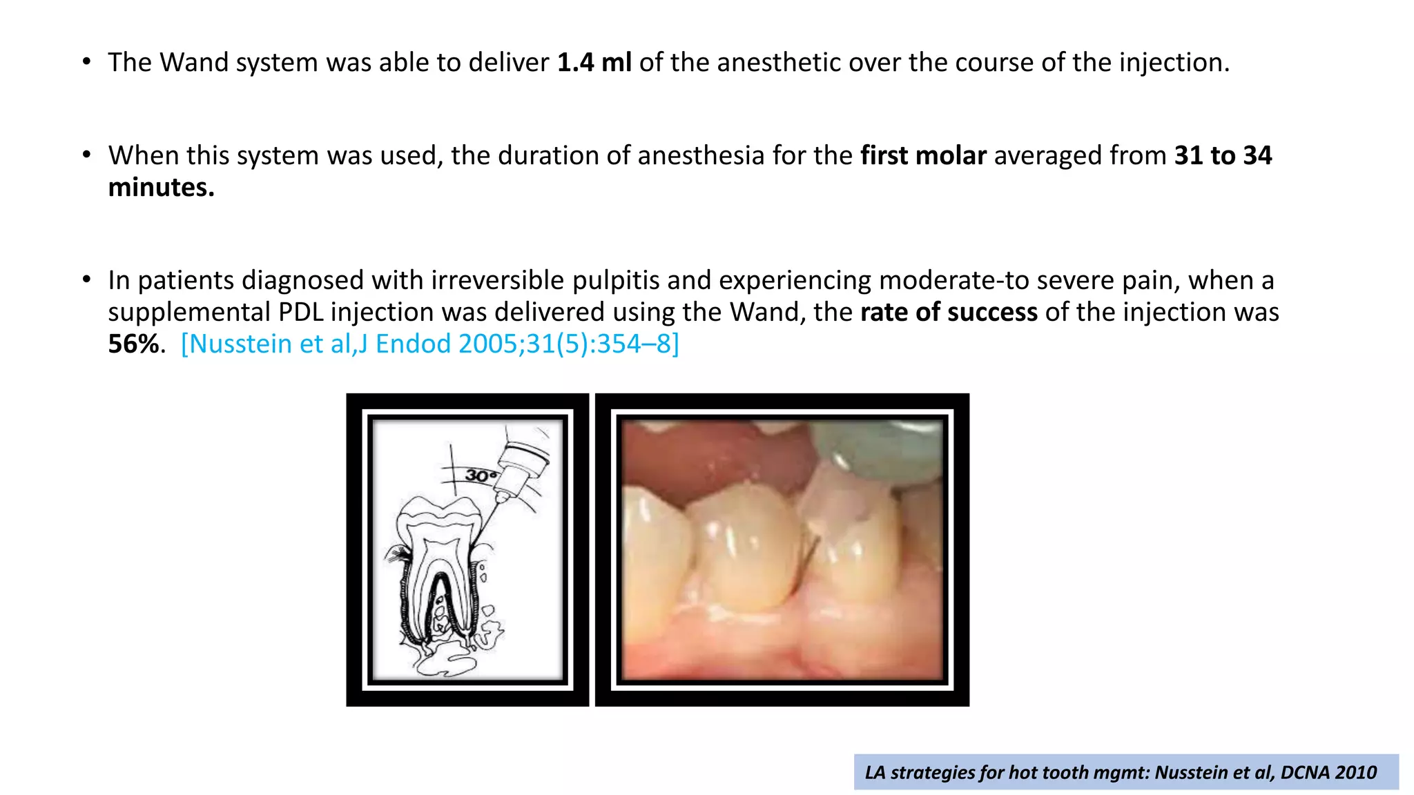 Management of hot tooth | PPTX