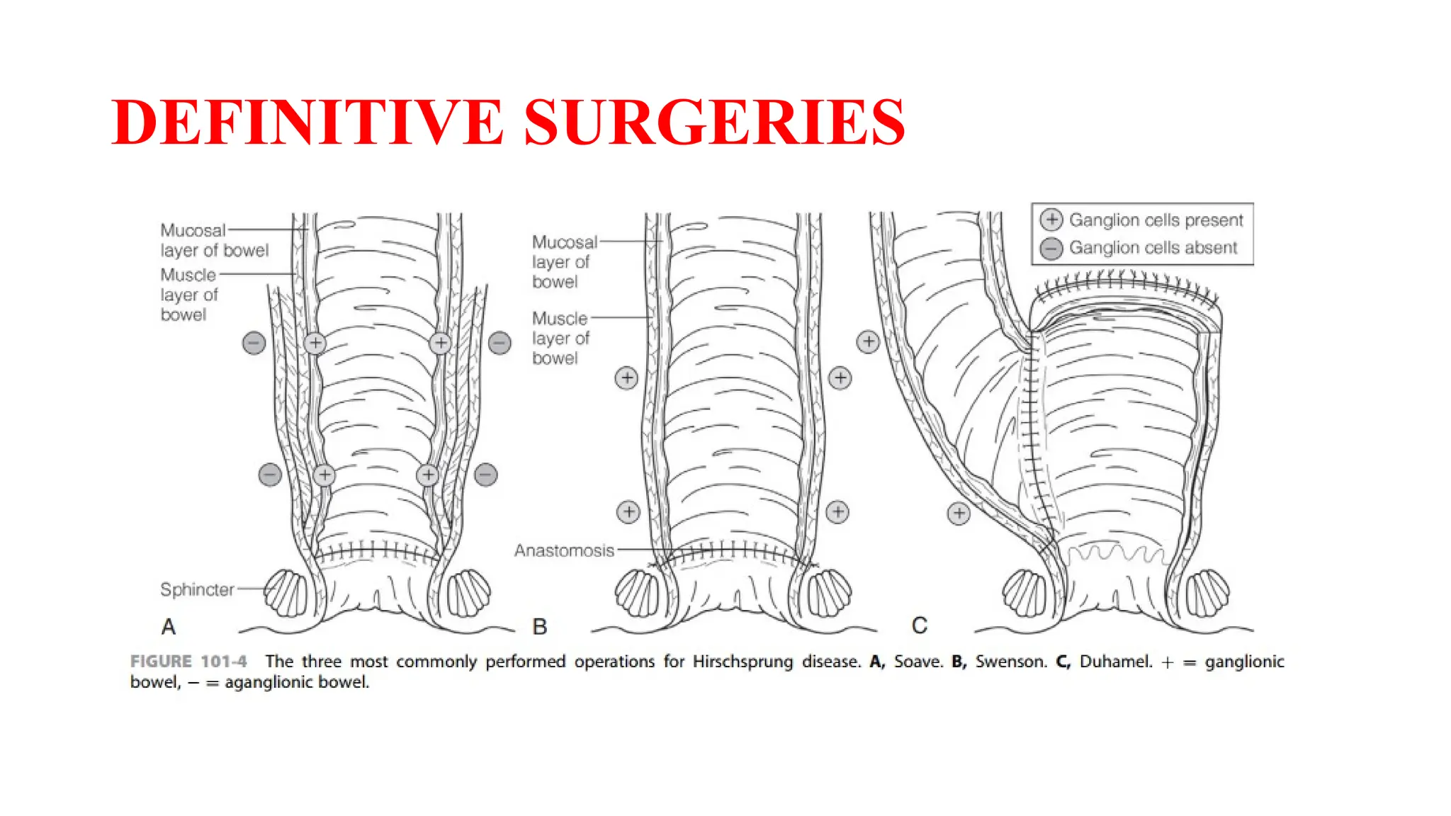 MANAGEMENT OF HSD AND ARM blacklion nahom.pptx