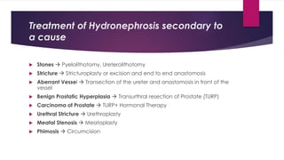 Management of hydronephrosis | PPTX | Surgery | Medical Health