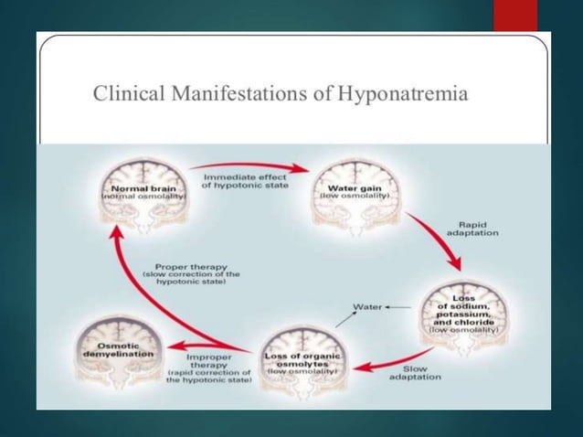 clinical MANAGEMENT OF HYPONATRAEMIA.pptx