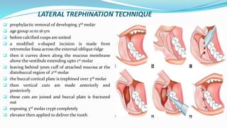Management of impacted3rd molar | PPT