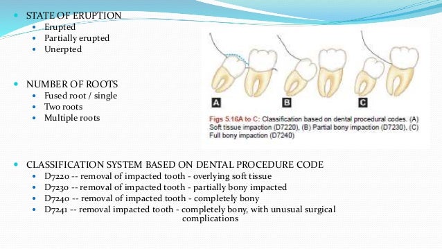 Management of impacted3rd molar