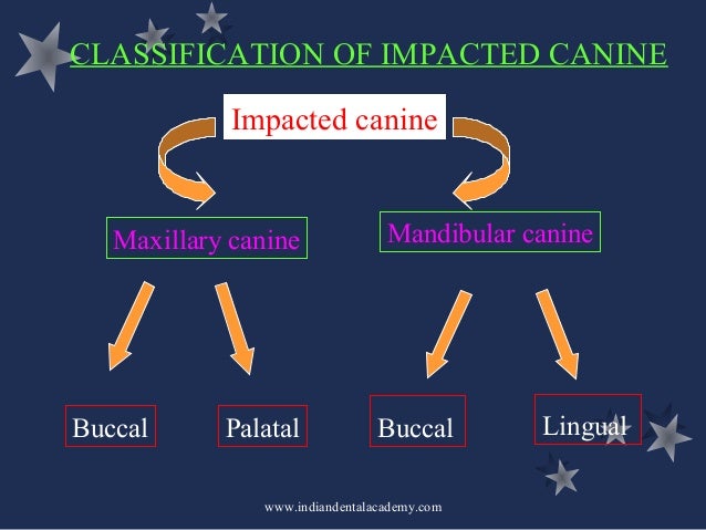 Management of impacted canine