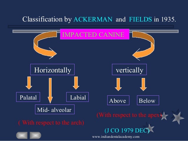 Management of impacted canine