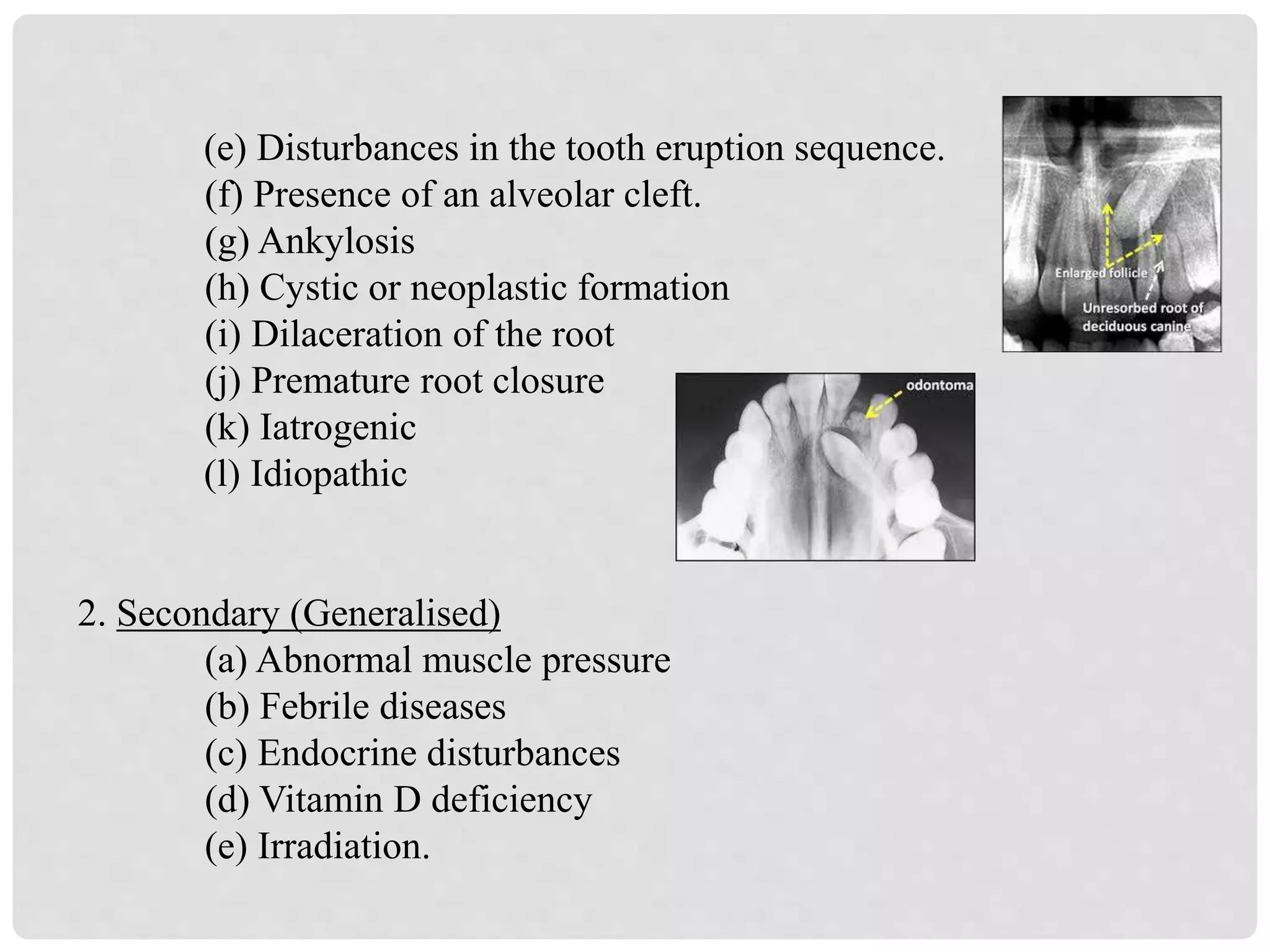 Management of impacted canines | PPTX