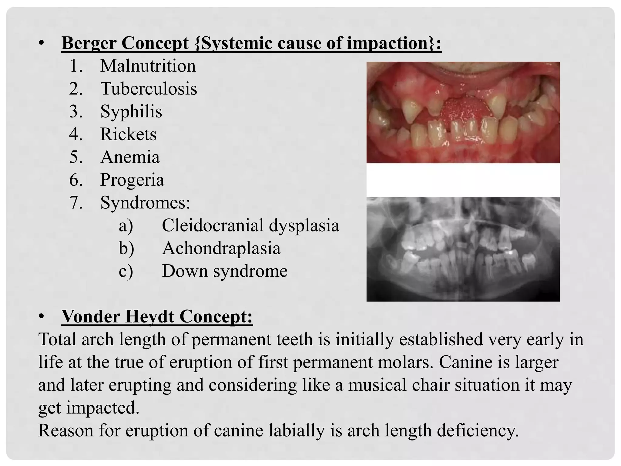 Management of impacted canines | PPTX