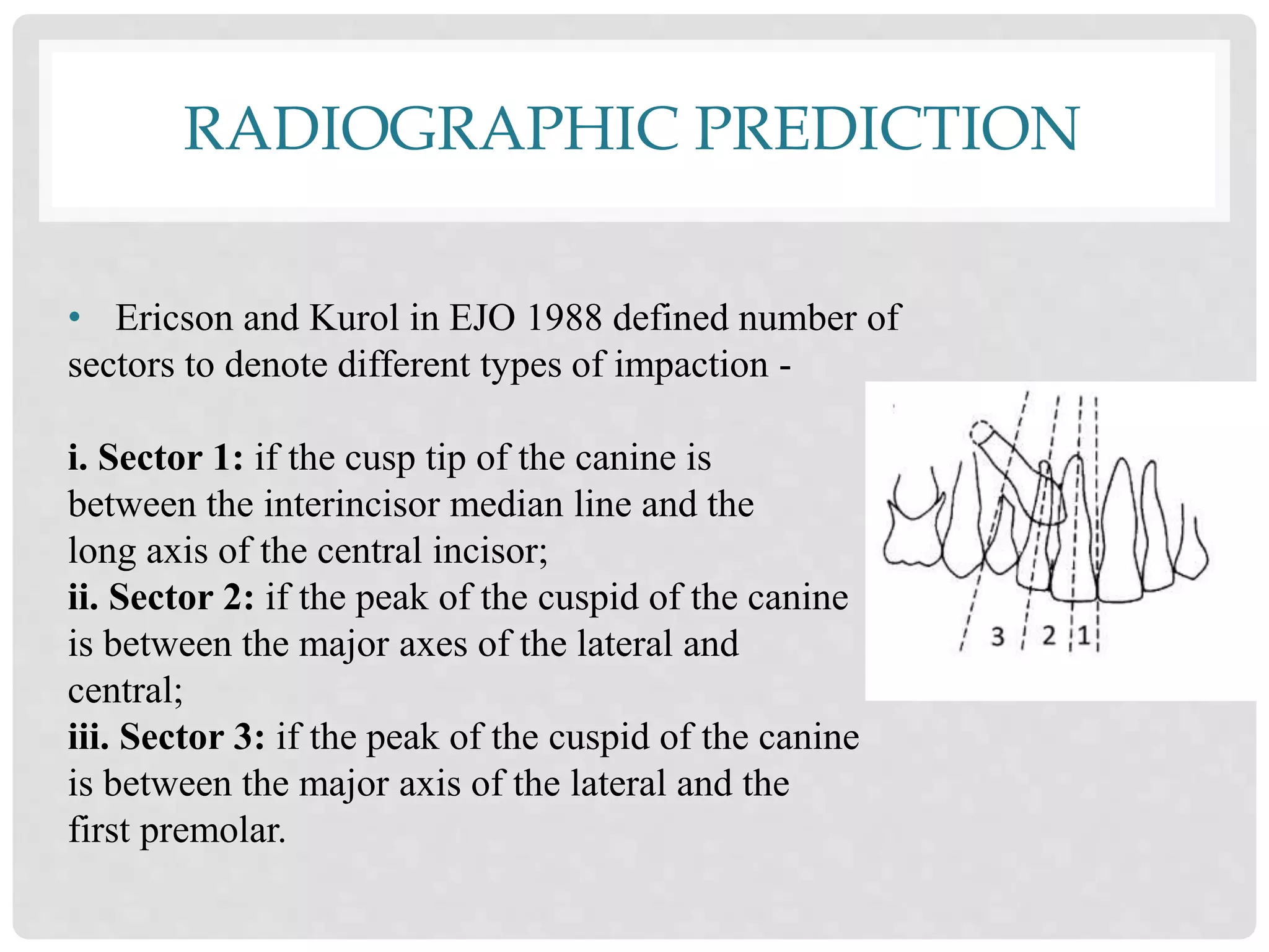 Management of impacted canines | PPTX