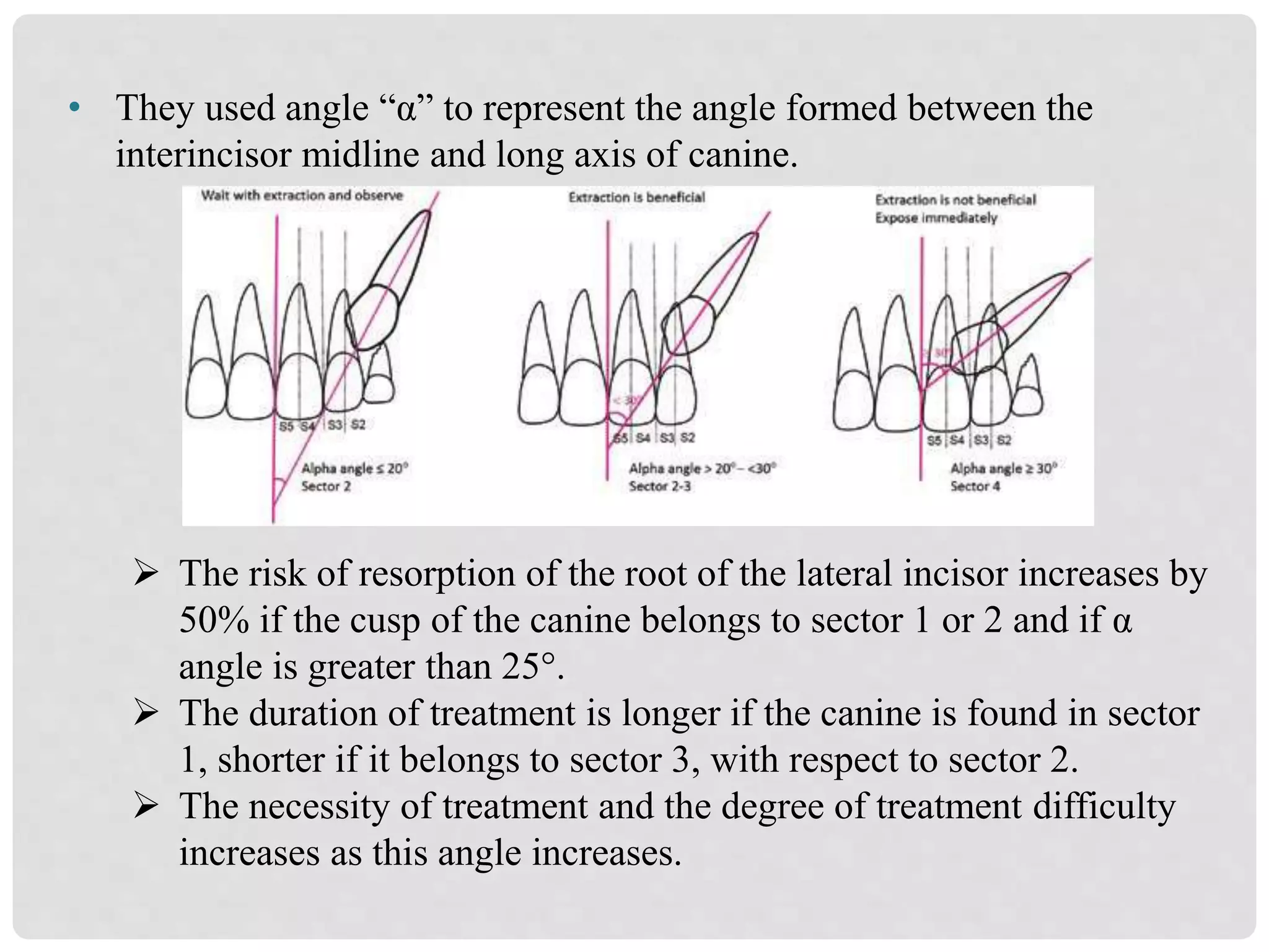 Management of impacted canines | PPTX