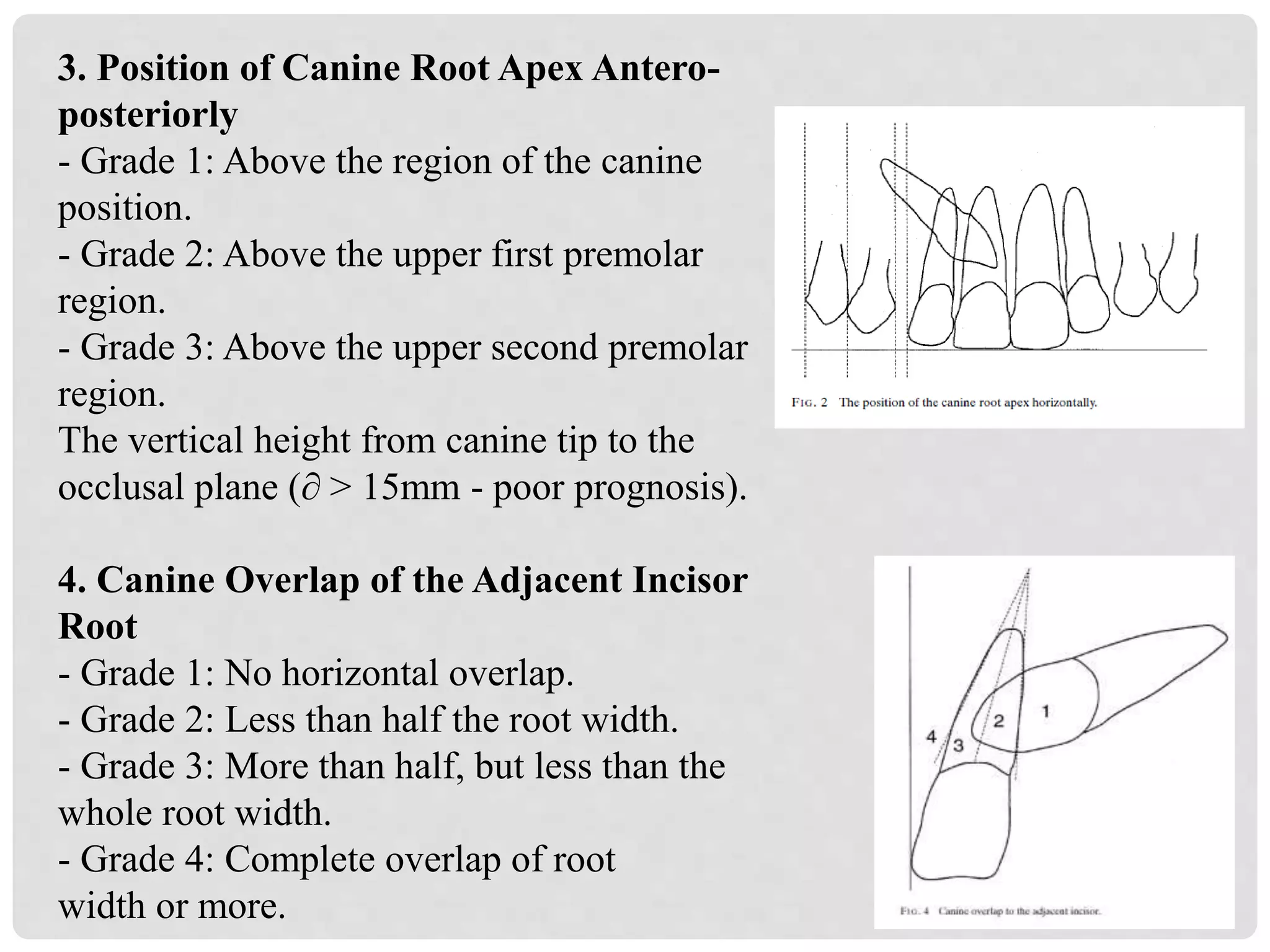 Management of impacted canines | PPTX