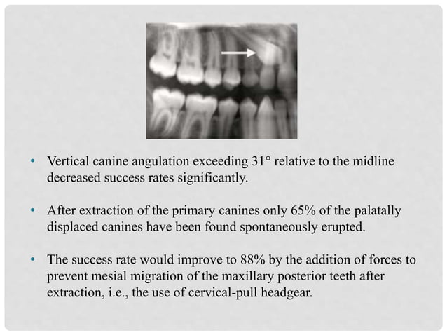 Management of impacted canines | PPTX | Dental Health | Diseases and ...