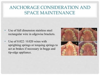 Management of impacted canines | PPTX