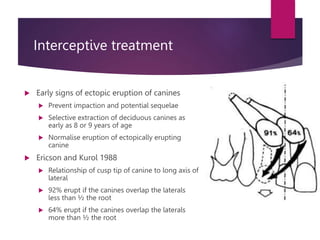 Management of impacted canines 2.pptx