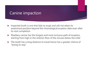 Management of impacted canines 2.pptx