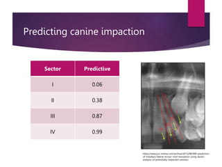 Management of impacted canines 2.pptx