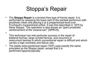 Management of inguinal hernia | PPT