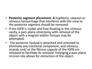 Management of intra ocular foreign body | PPTX