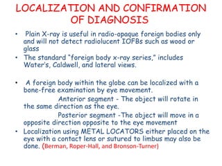 Management of intra ocular foreign body | PPTX