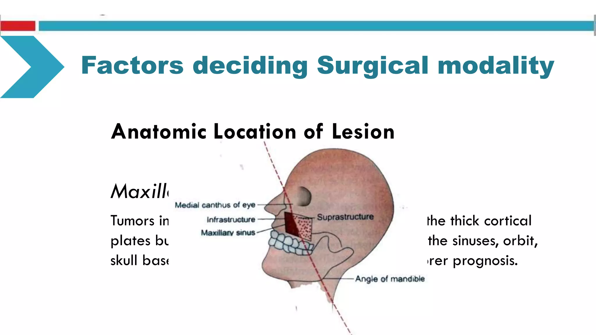Management of jaw tumors | PPSX