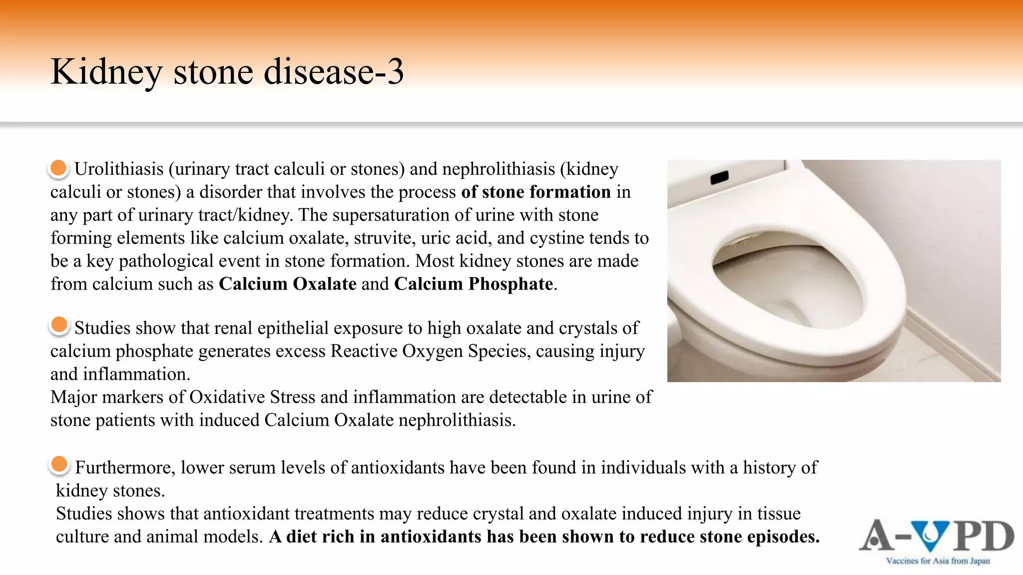 Management of kidney stones and JIN product information | PPTX