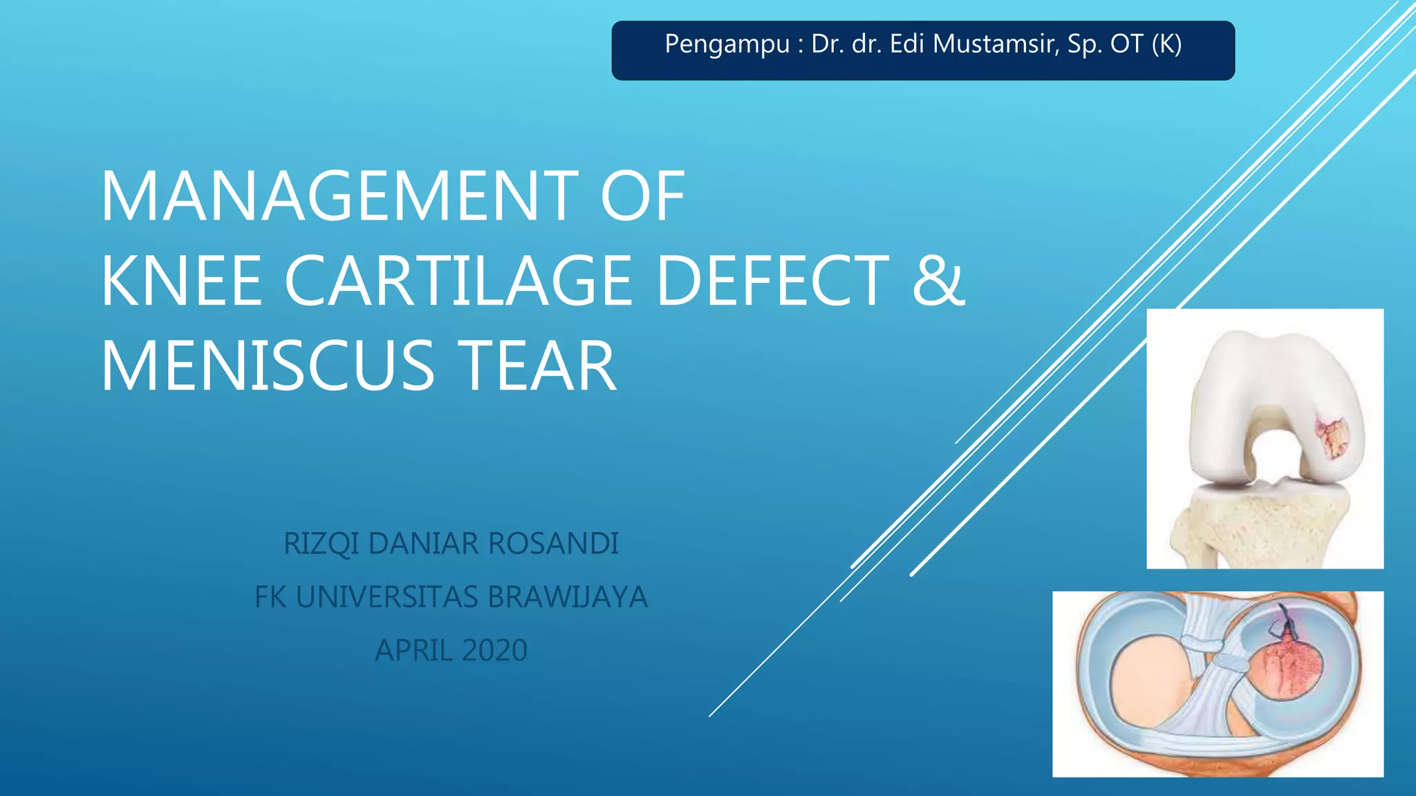 Management of knee cartilage defect & meniscus tear | PPTX