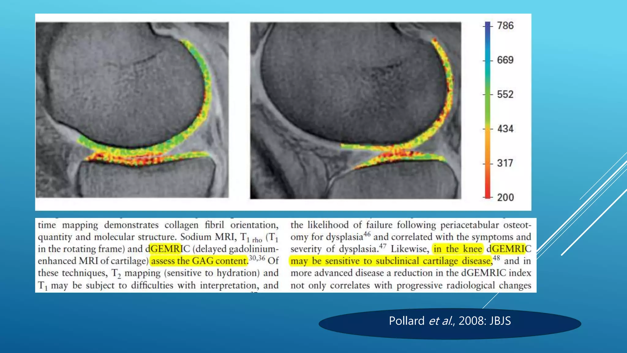 Management of knee cartilage defect & meniscus tear | PPTX