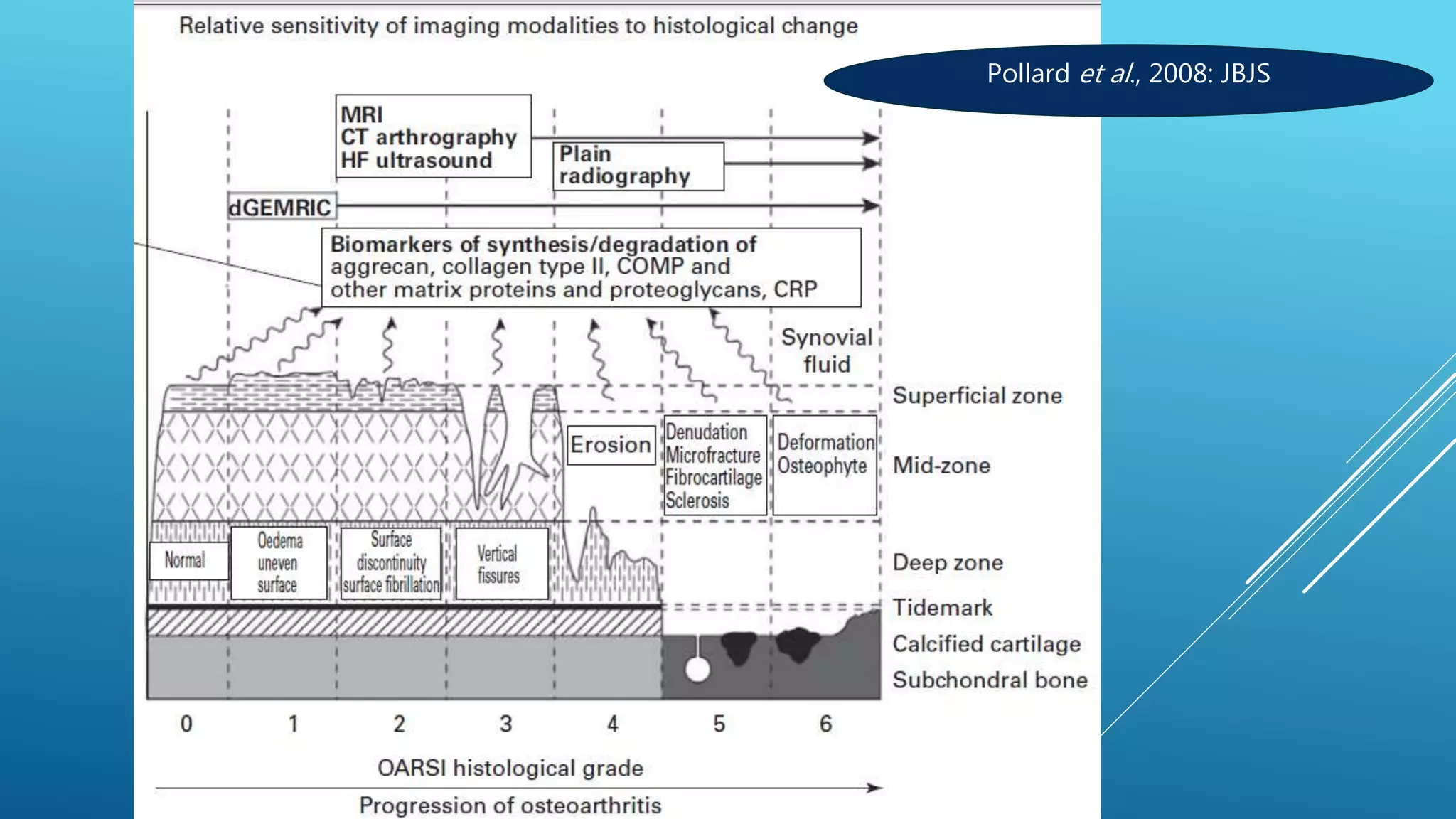 Management of knee cartilage defect & meniscus tear | PPTX