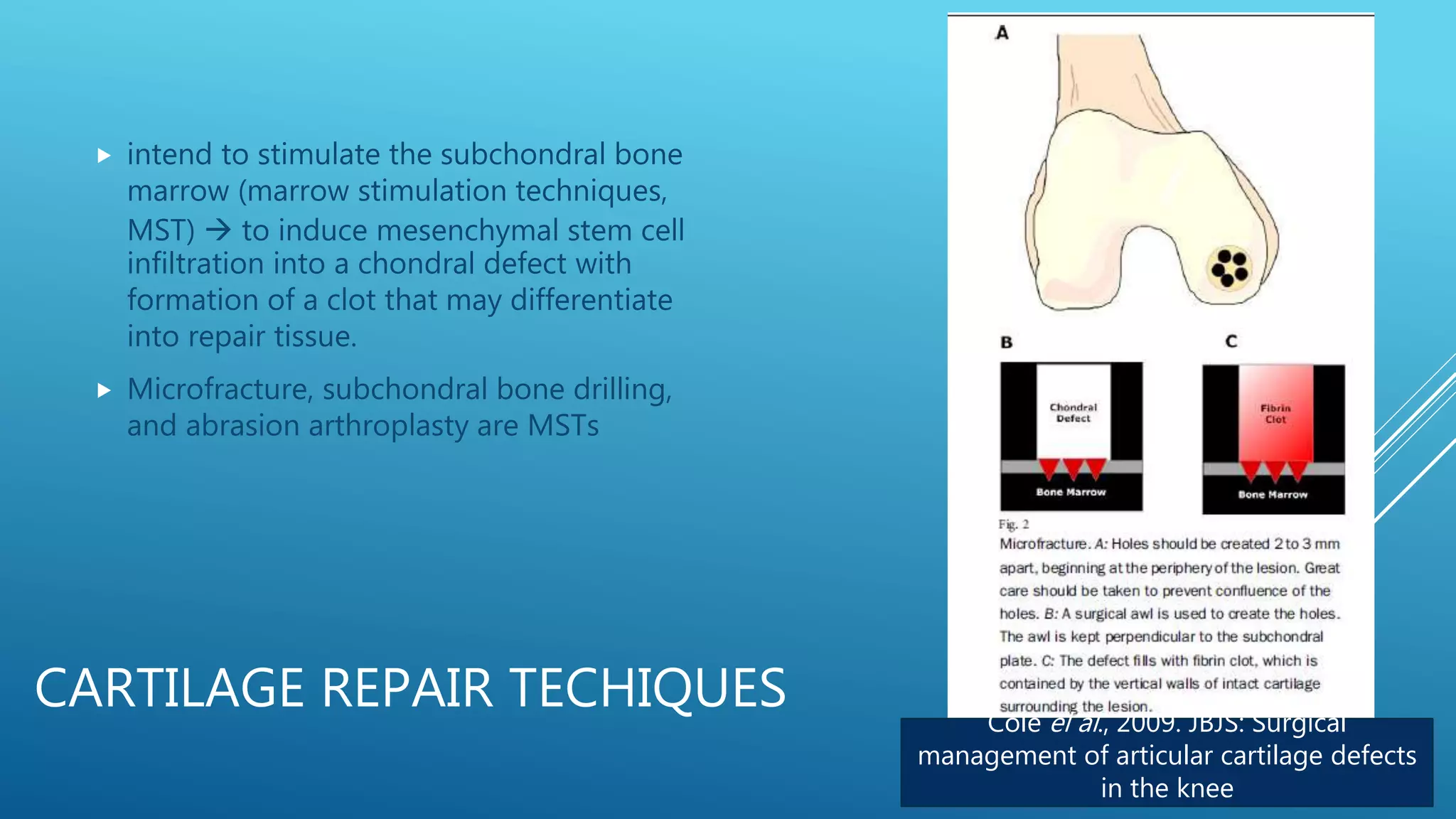 Management of knee cartilage defect & meniscus tear | PPTX