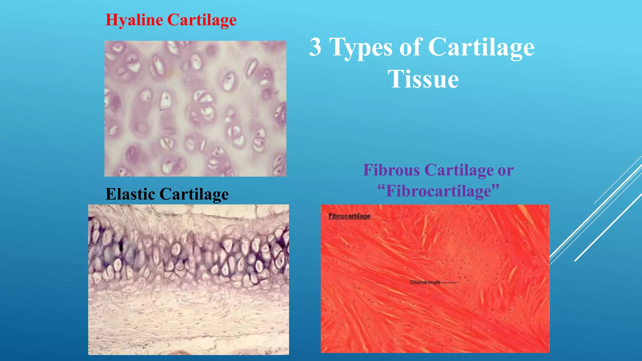 Management of knee cartilage defect & meniscus tear | PPT