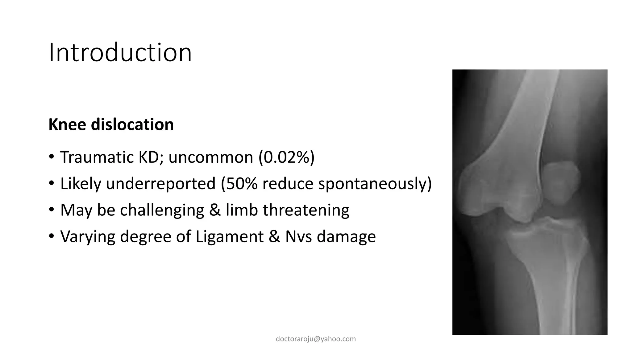 Management of knee dislocation | PPTX