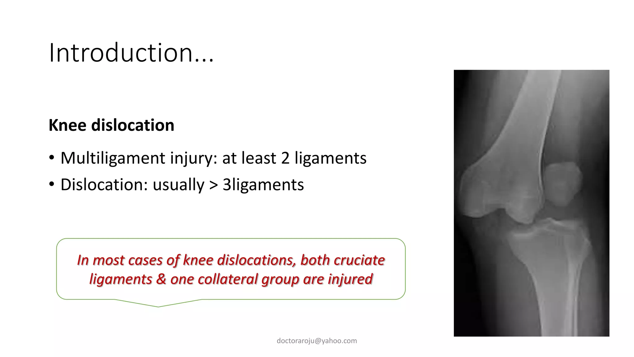 Management of knee dislocation | PPTX