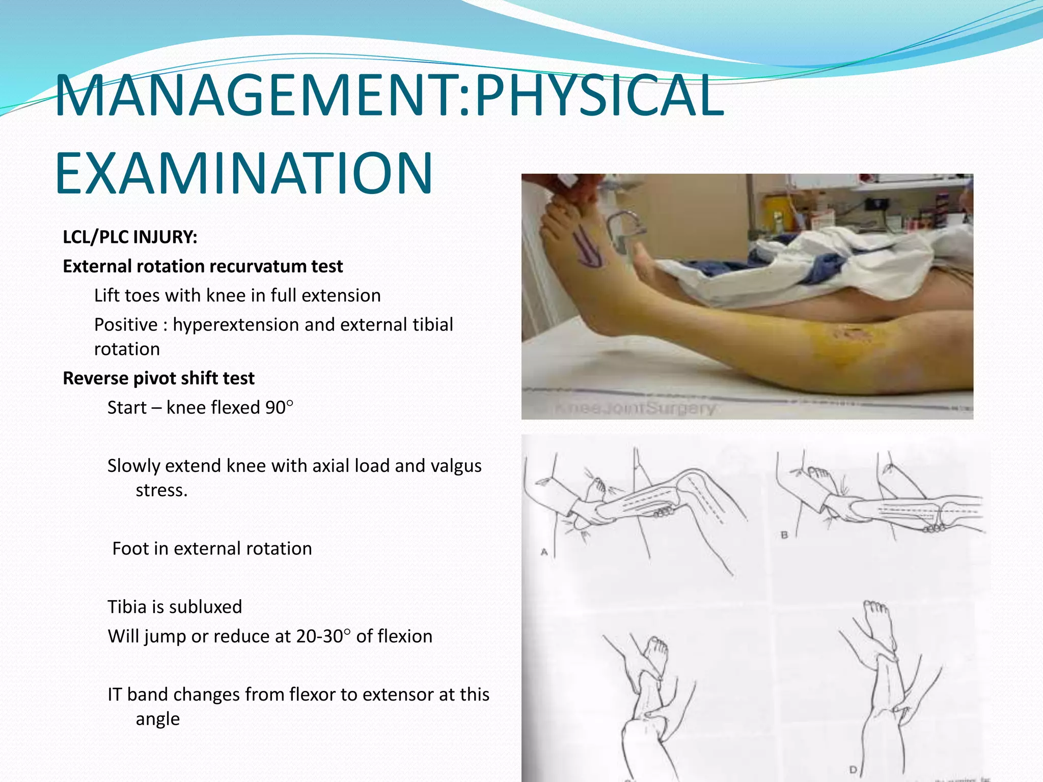 management of knee ligament injuries 2.pptx