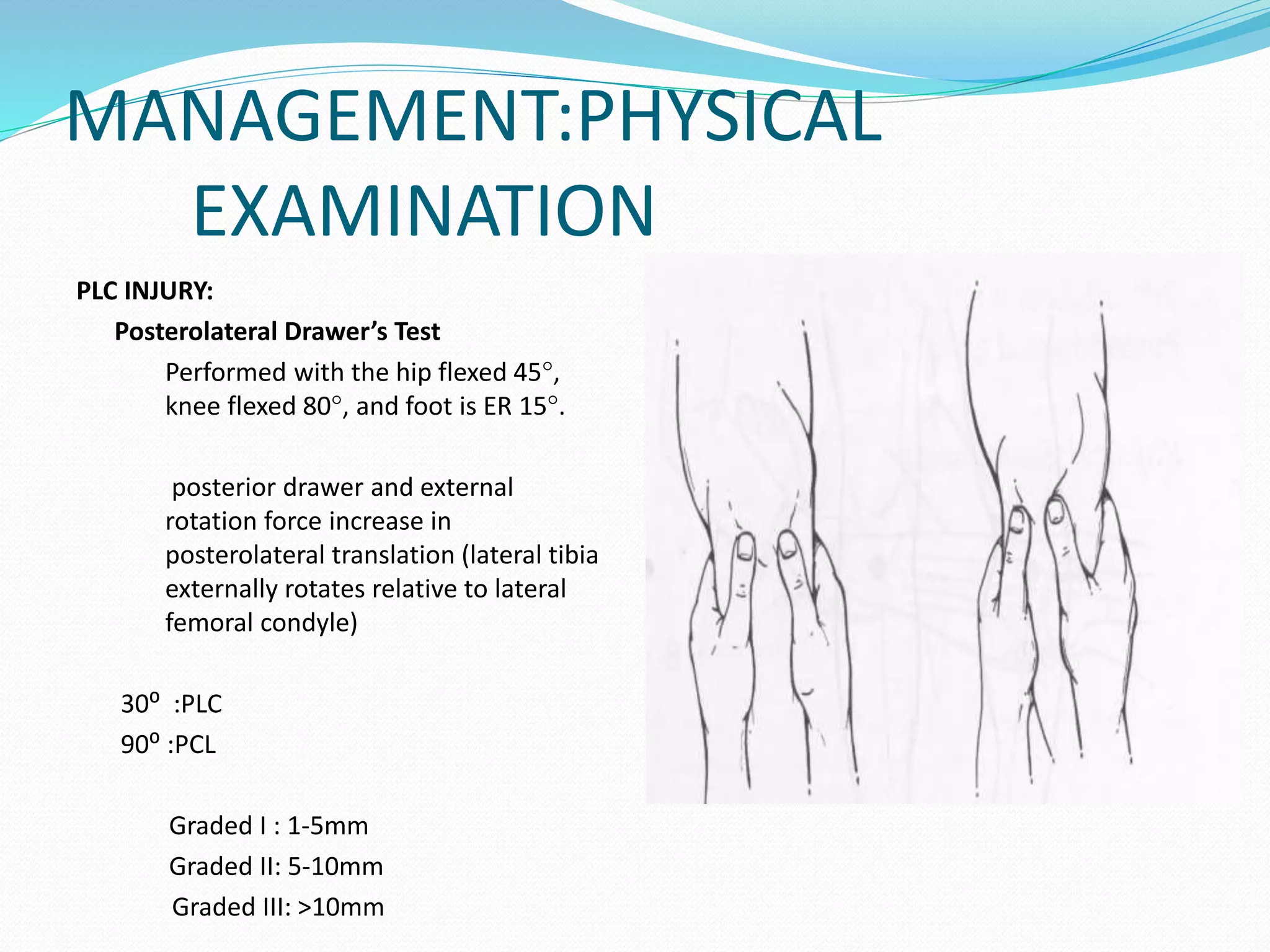 management of knee ligament injuries 2.pptx