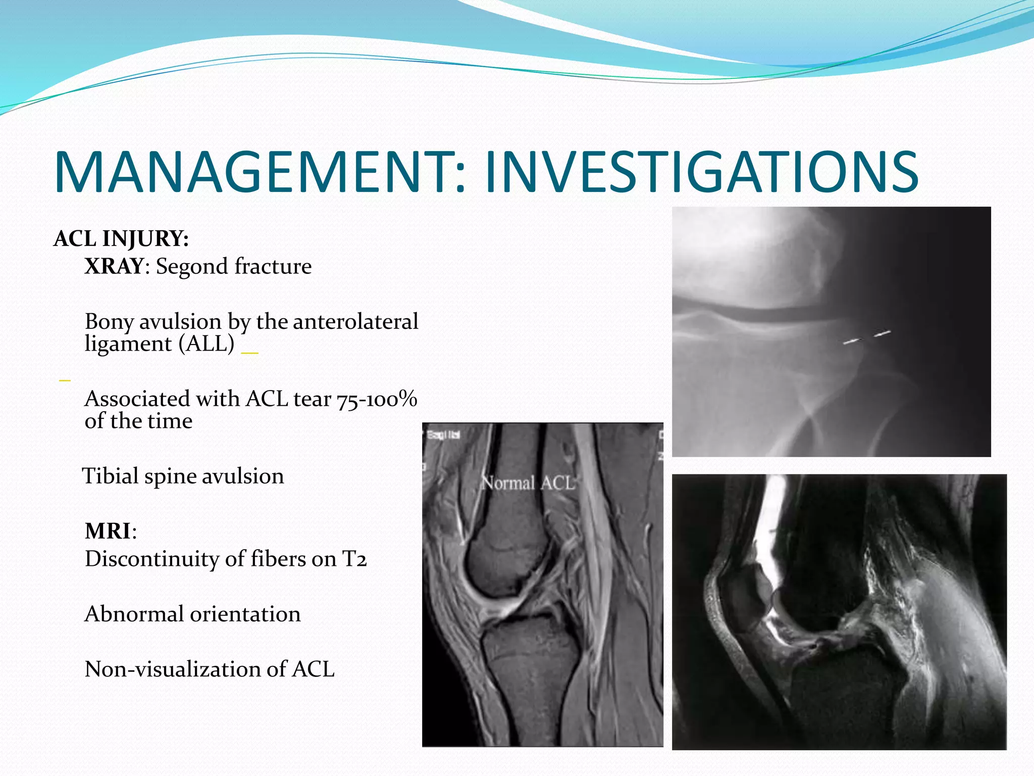 management of knee ligament injuries 2.pptx