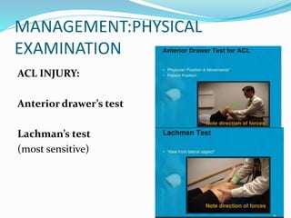 management of knee ligament injuries 2.pptx