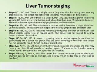 Management Of Large Liver Tumors | PPT