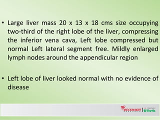 Management Of Large Liver Tumors | PPT