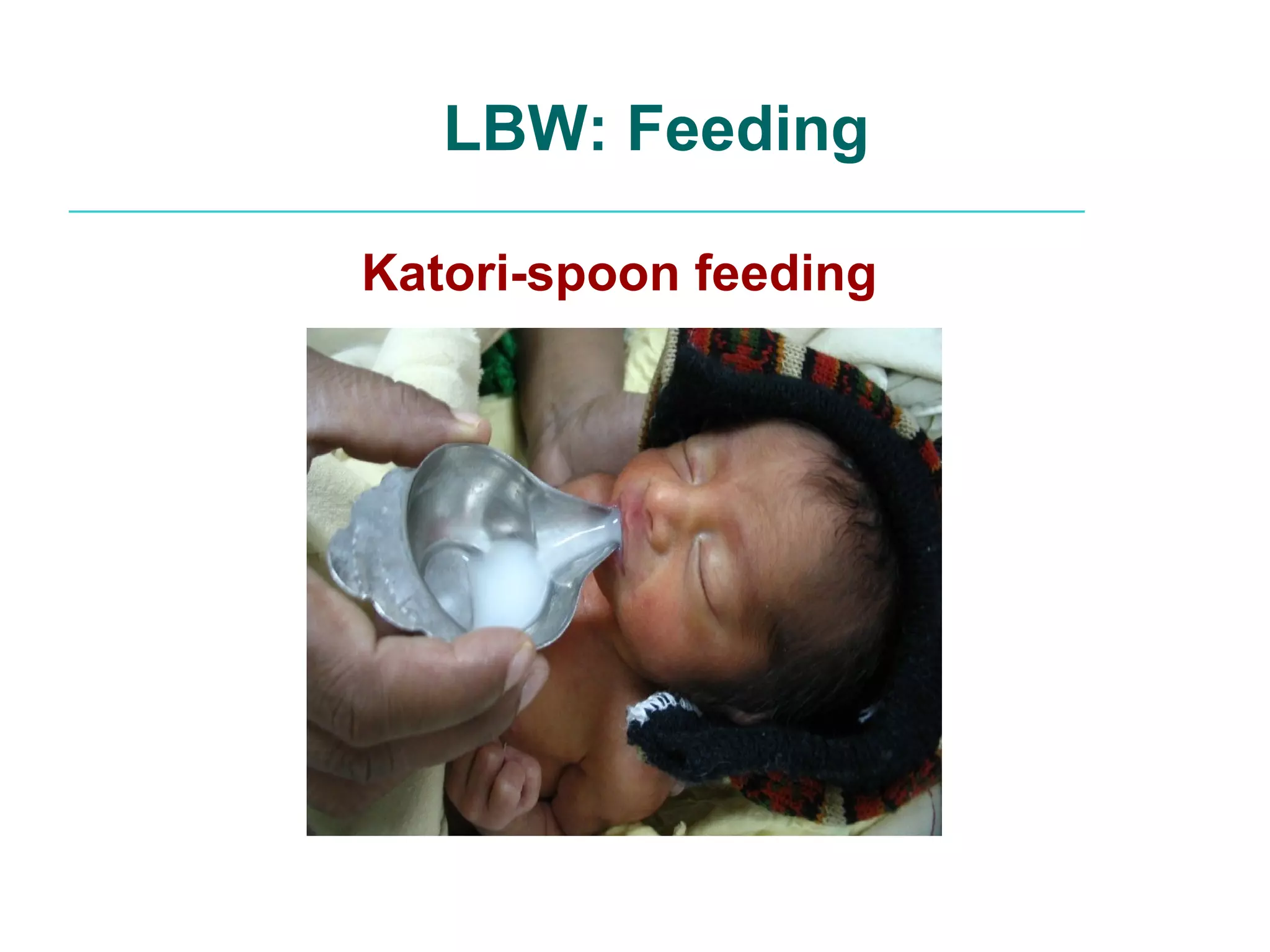 Management of lbw low birthweight babies | PPT