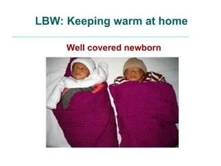 Management of lbw low birthweight babies | PPT