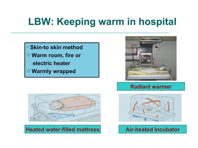 Management of lbw low birthweight babies | PPT
