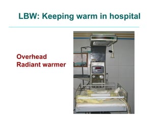 Management of lbw low birthweight babies | PPT