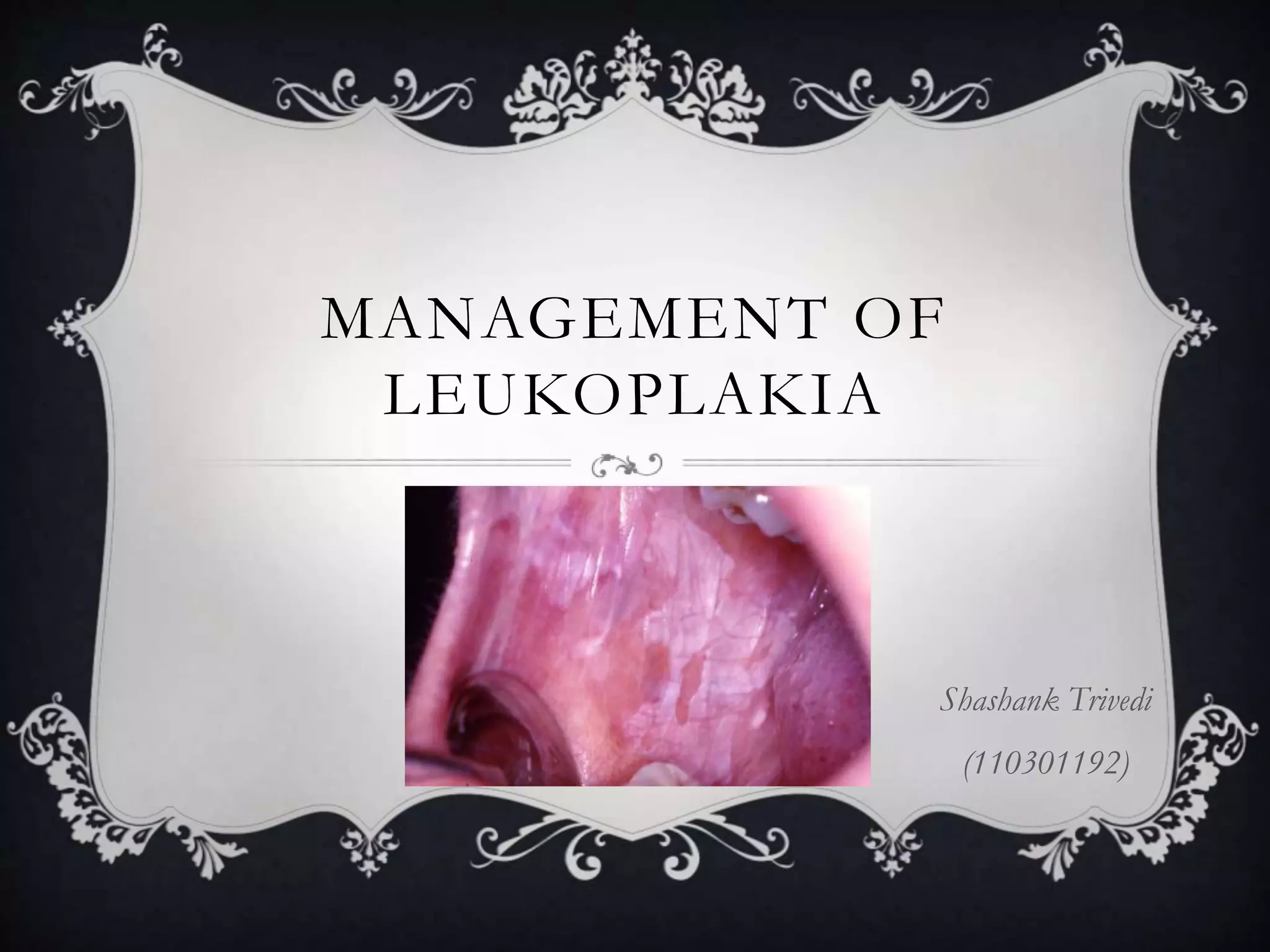 Management of leukoplakia | PPTX