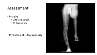 Management of LLD and bone gaps | PPTX