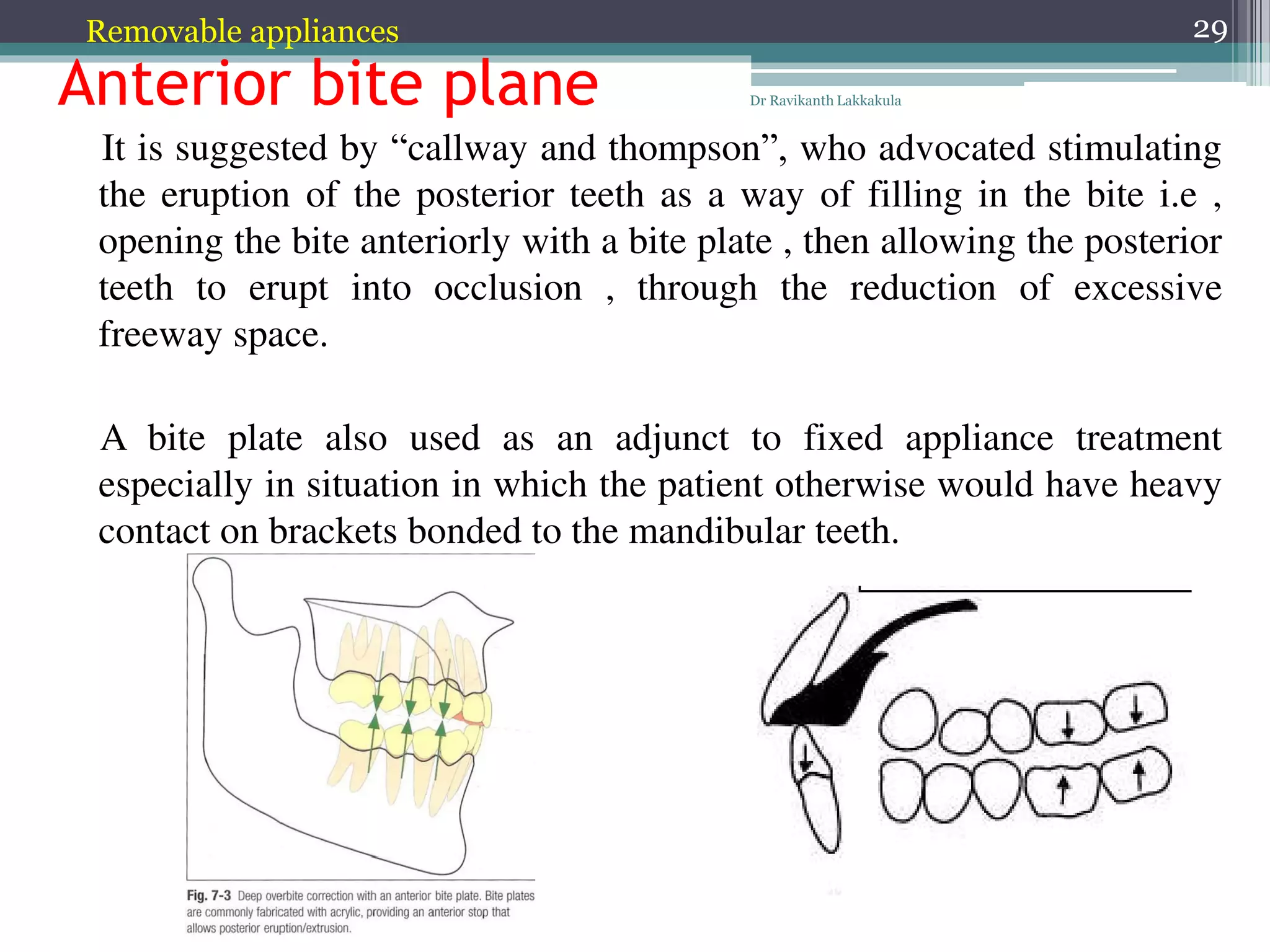 Management of low angle case in orthodontics | PDF
