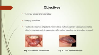 Management of low flow vascularmalformations.pptx