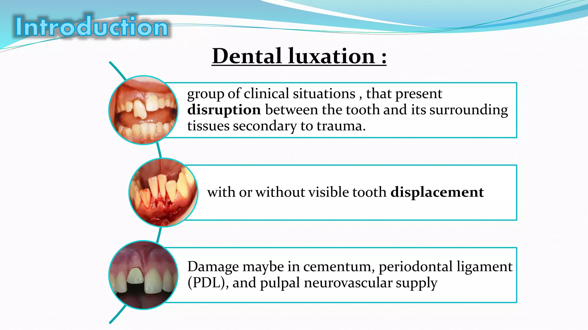 Management of luxation injuries | PPTX