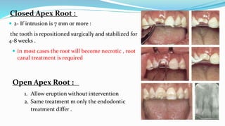 Management of luxation injuries | PPTX | Dental Health | Diseases and ...