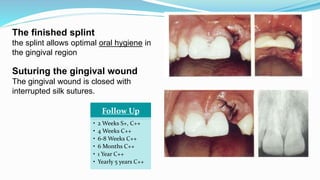 Management of luxation injuries | PPTX | Dental Health | Diseases and ...