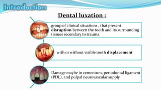 Tooth Luxation
